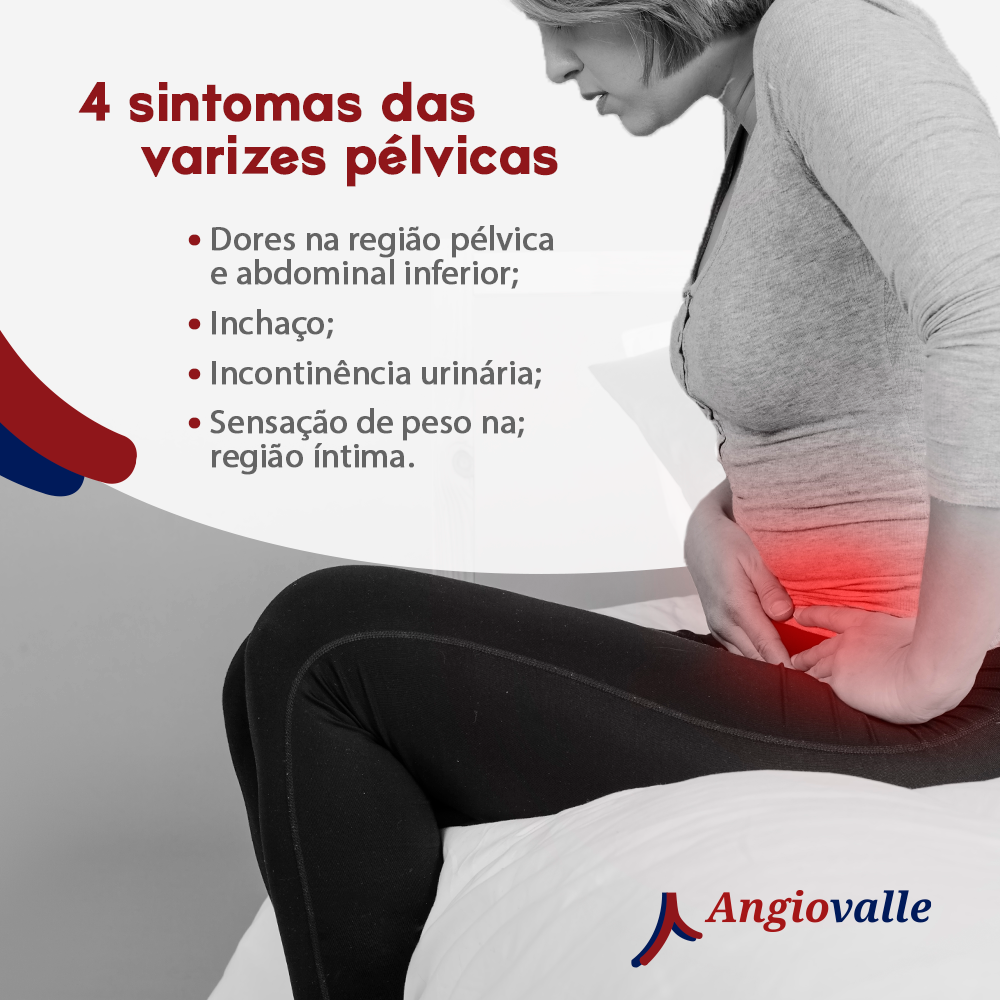 Varizes Pélvicas - AngioViva