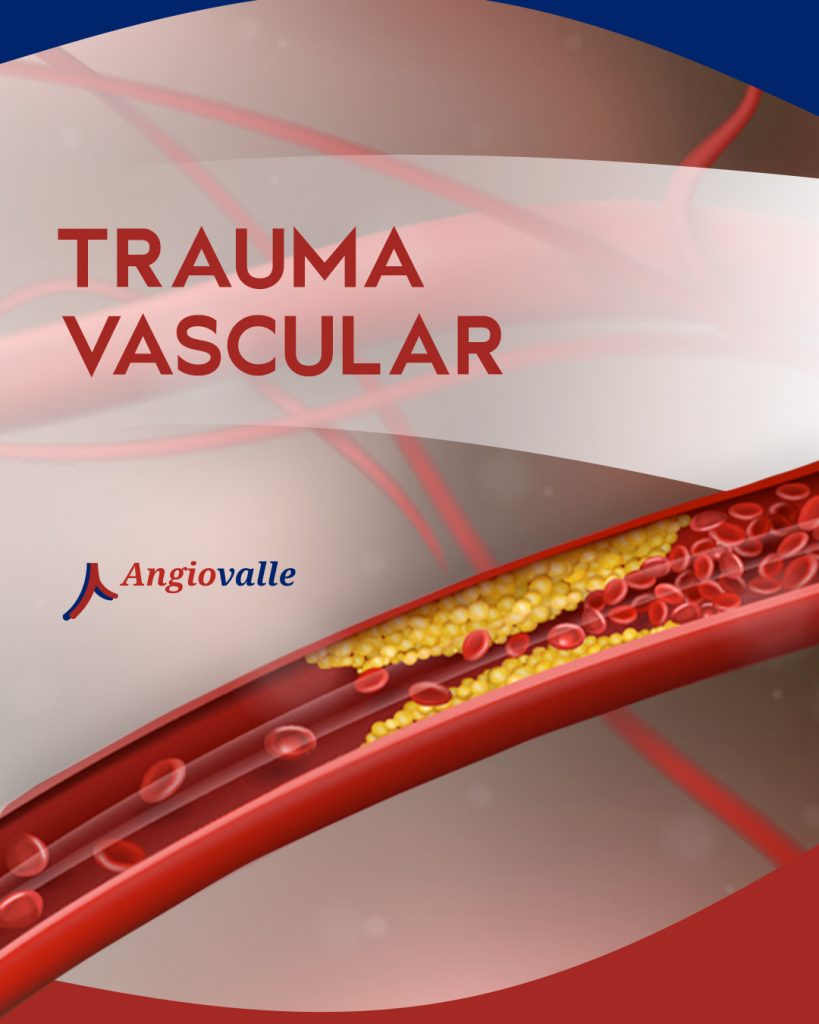 Trauma Vascular, entenda do que se trata - AngioViva