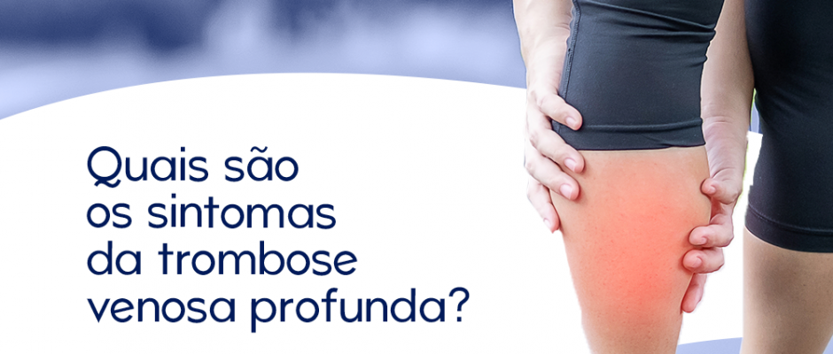 Quais são os sintomas da trombose venosa profunda? - AngioViva